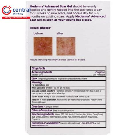 Gel Trị Sẹo Mederma Advanced Scar Gel Trị Sẹo Hiệu Quả