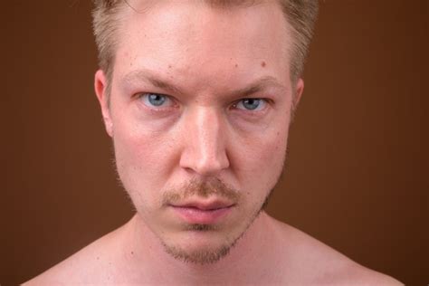 Pimple Face Male Pictures Freepik