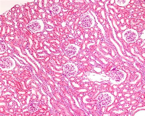 Renal Medulla Histology