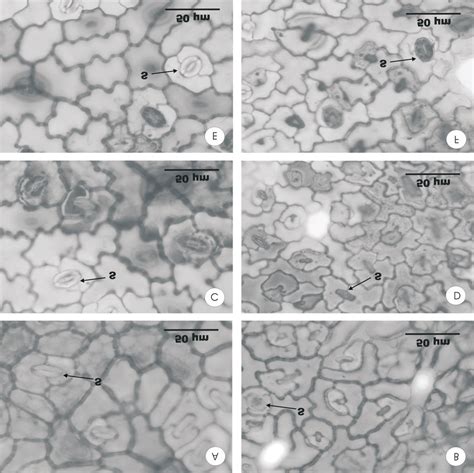 Sem Photomicrographs Of Transverse Sections Of Leaves Of Ocimum Selloi