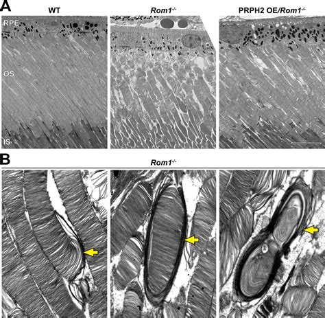 Rom1 Is Redundant To Prph2 As A Molecular Building Block Of Photoreceptor Disc Rims Elife