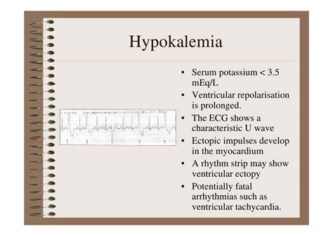 Cardiac Ecg Interpretation