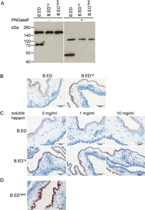 Expression Of Recombinant Ibv Beaudette Spike Ectodomains And Analysis Download Scientific