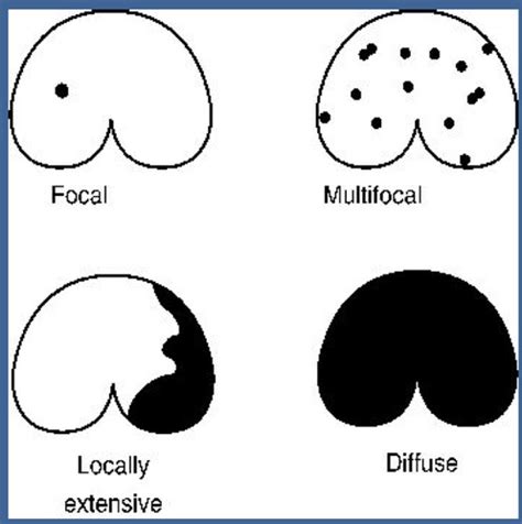 Pathology I Basic Concepts Flashcards Quizlet