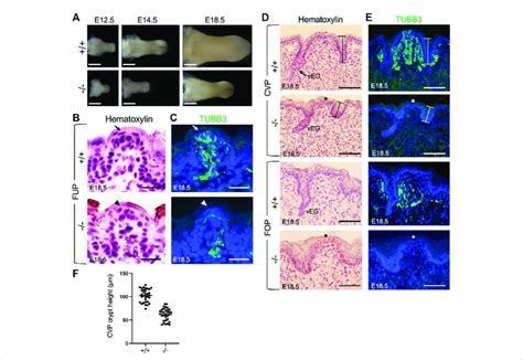 Eya1 Deficiency Leads To Growth Arrest Of Tongue And Taste Papillae