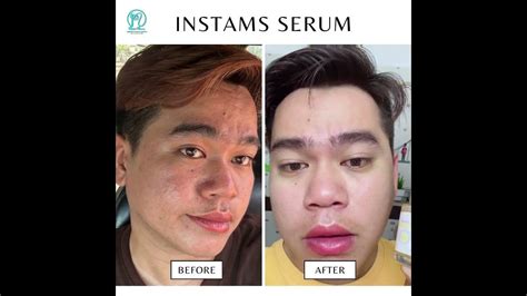 🌊សេរ៉ូម Vitamin C ជាសេរ៉ូមល្អលេខមួយមកពីកូរ៉េ 🇰🇷សម្រាប់ស្បែកមុខធម្មតា ស្បែកមុខខ្វះវីតាមីន Youtube