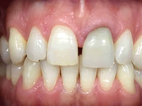 Gallery Murdoch Dental And Implant Centre