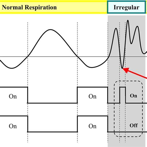 Schematic Illustration Of The Phase‐gated Beam Delivery With An Download Scientific Diagram