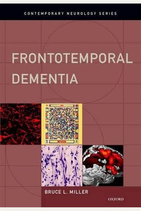 Buy Frontotemporal Dementia Book By Bruce L Miller