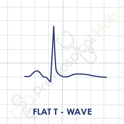 T Waves - Prehospital Hub