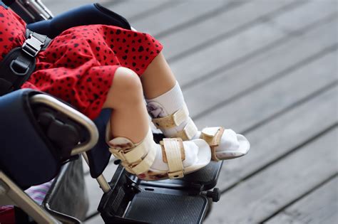 Parálisis Cerebral Infantil Causas y Tratamientos Físicos Brainter