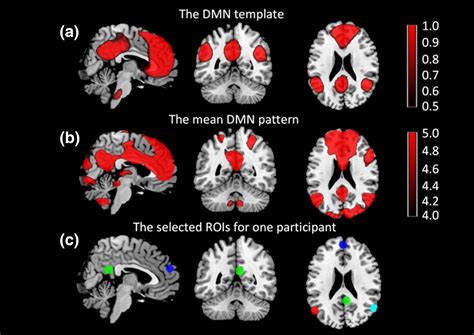 Abnormal Resting State Effective Connectivity Within The Default Mode Network In Major