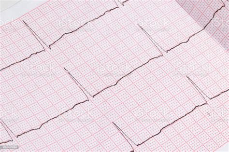 종이 형태로 의료 의료 심전도의 클로즈업 건강 진단에 대한 스톡 사진 및 기타 이미지 건강 진단 건강관리와 의술 건강한