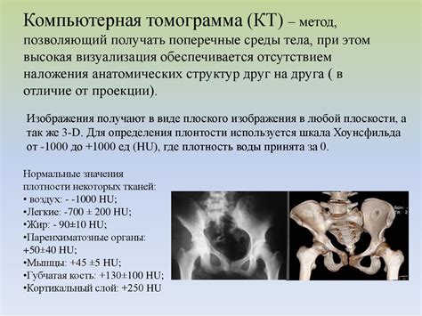 Дополнительные методы исследования в травматологии и ортопедии