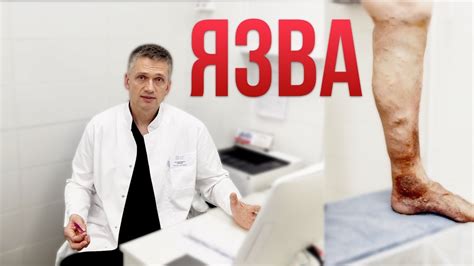 Почему появляется язва на ноге Причём здесь варикоз и помогут ли мази Youtube