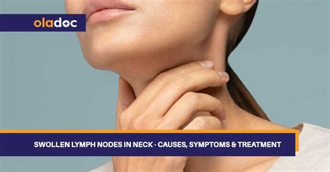 Swollen Lymph Nodes Neck Strep Throat