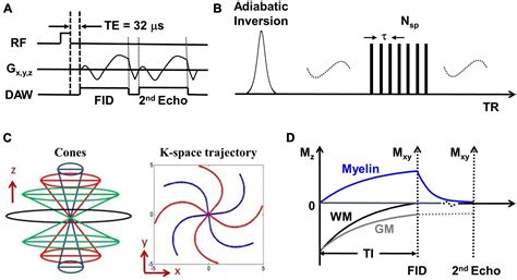 The Signal Intensity Variation Of Multiple Sclerosis MS Lesions On