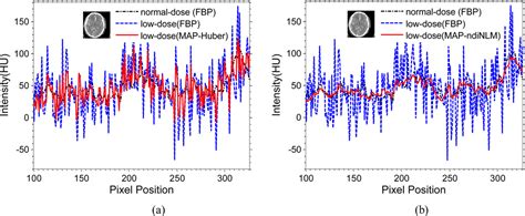 Iterative Image Reconstruction For Cerebral Perfusion Ct Using A Pre Contrast Scan Induced Edge