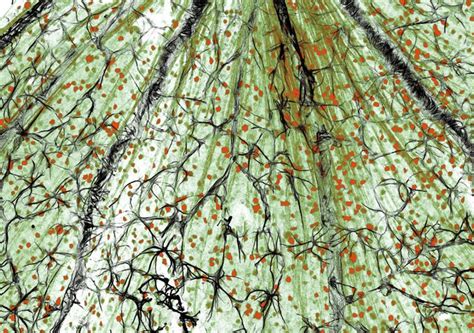 Retinal Astrocytes A Tapestry Of Cells In A Mouse Retina Reveals A Network Of Spidery