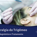 Nevralgia do Trigêmeo Sintomas e Causas Dr Diego De Castro