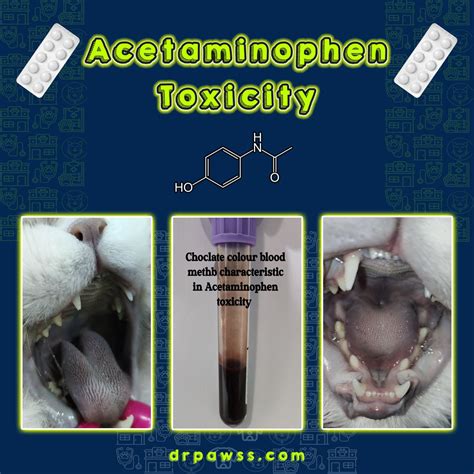 Dr Paws On Linkedin 💫acetaminophen Toxicity💫 Acute Oral Intoxication