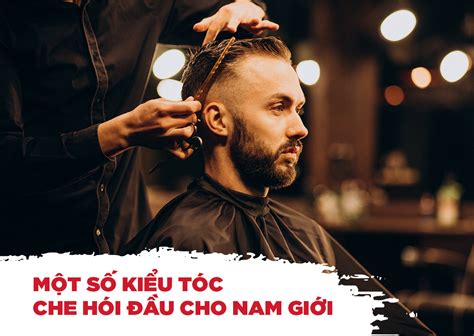 Một Số Kiểu Tóc Che Hói Đầu Cho Nam Giới