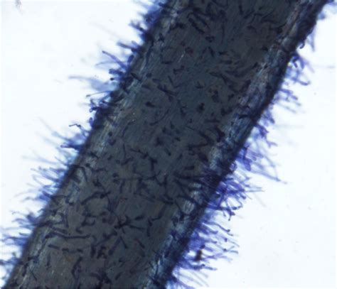 Imaging And Analyzing Root Hair Length And Density — Department Of