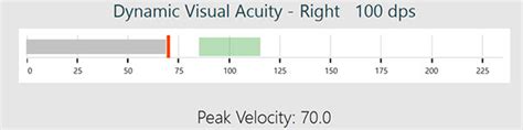 Visualeyes™ Dynamic Visual Acuity Dva Interacoustics