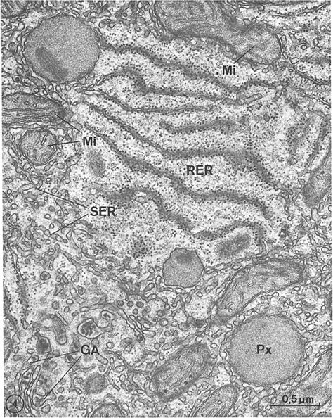 An Area Of Hepatocytic Cytoplasm Illustrating Mitochondria Mi The