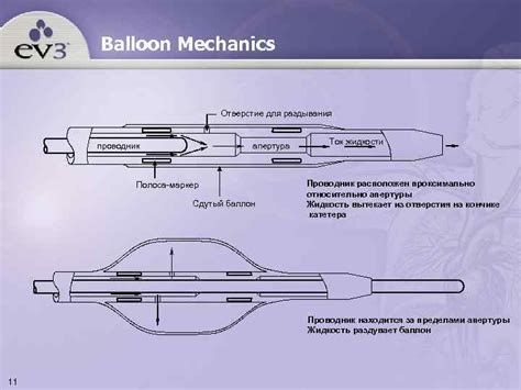 Баллонные катетеры для ангиопластики Balloon Types l