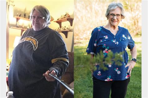 Kc Bariatric Transforming Lives With Weight Loss Solutions
