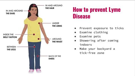 Lyme Disease Youtube