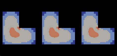Mesh Pattern Comparison On The Fichera Corner Problem In 2d With Ten
