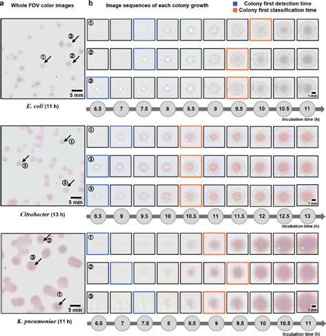 Visual Evaluation Of Coliform Bacterial Colonys Early Detection And Download Scientific