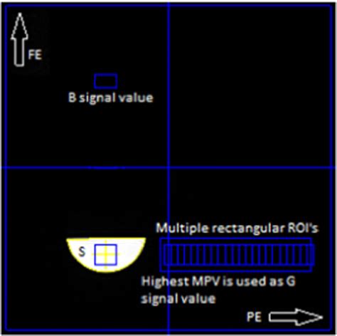Image Shows Roi Positioning For The Ipem Method Fe Is Frequency Encode Download Scientific