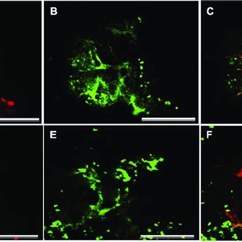 Confocal Microscopy Double Immunofluorescence For GFAP Red And IDS