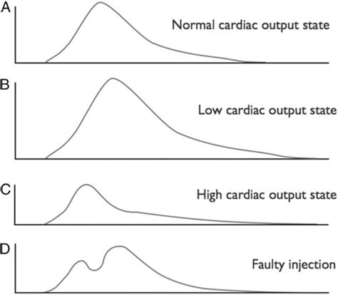 Cardiac Index And Output Flashcards Quizlet
