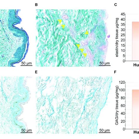 Evaluation Of The Effectiveness Of The Decellularization Procedure Of