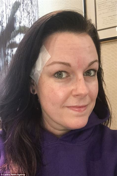 Mother Has A Hole In Her Face Due To Skin Cancer Daily Mail Online