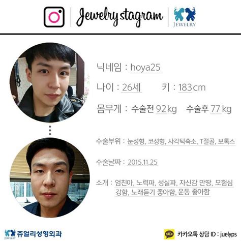 쥬얼리성형외과 [쥬얼리스타그램🌟] 닉네임 Hoya25 나이 26세 키