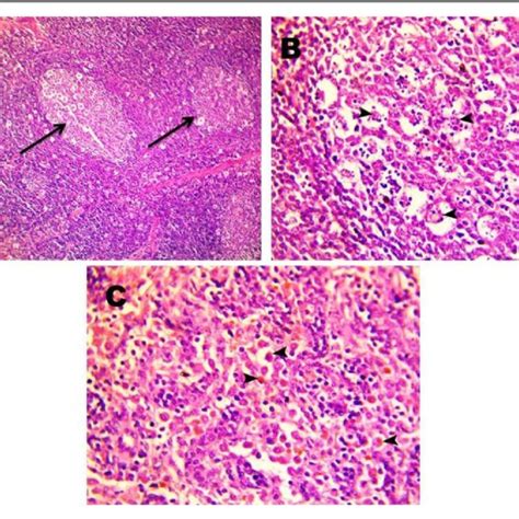 A C Mesenteric Lymph Node Calf Shows A Multifocal Areas Of