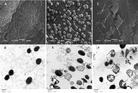 Sem Micrographs Of Mrsa M 4 Cells A Micrograph Of Untreated Cells