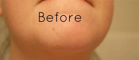 Elle Sees Beauty Blogger In Atlanta How To Hide A Pimple Using Drugstore Products