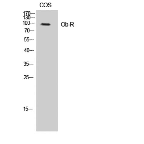 Anti Lepr Leptin Receptor Antibody Rabbit Anti Human Lsbio