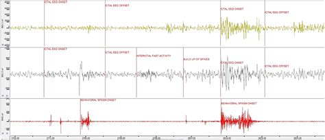 Journal Of Clinical Neurophysiology