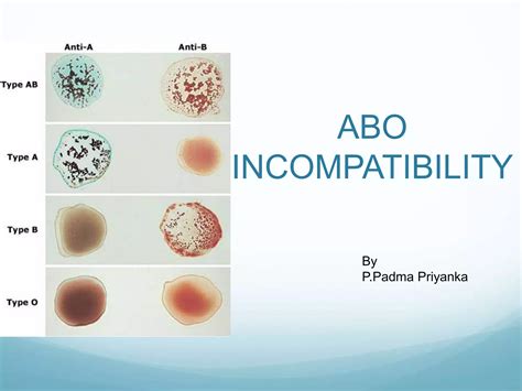 Abo Incompatibility Pptx Pregnancy Reproductive Health Abo Incompatibility Pptx Pregnancy Reproductive Health