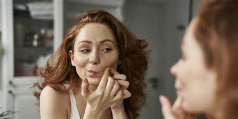 How To Get Rid Of A Blind Pimple According To Dermatologists