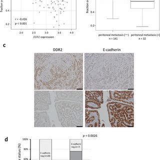 DDR Expression Was Associated With Peritoneal Dissemination And Poor Download Scientific