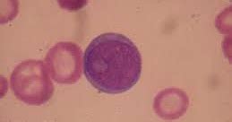 HEMATOLOGIA Eritroblasto Policromático