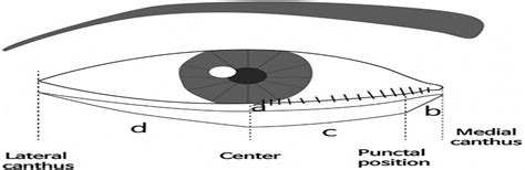 Surgical Correction Of Lower Lid Epiblepharon With Skin Only
